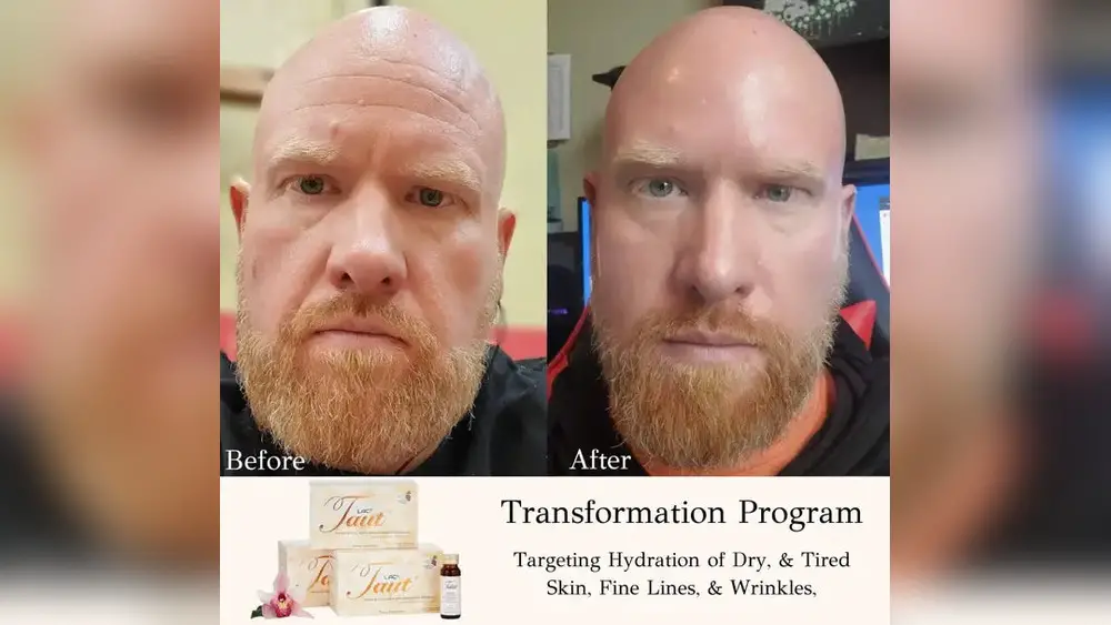 Do Collagen Supplements Work: Truth Revealed for Glowing Skin ...